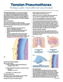 open pneumothorax